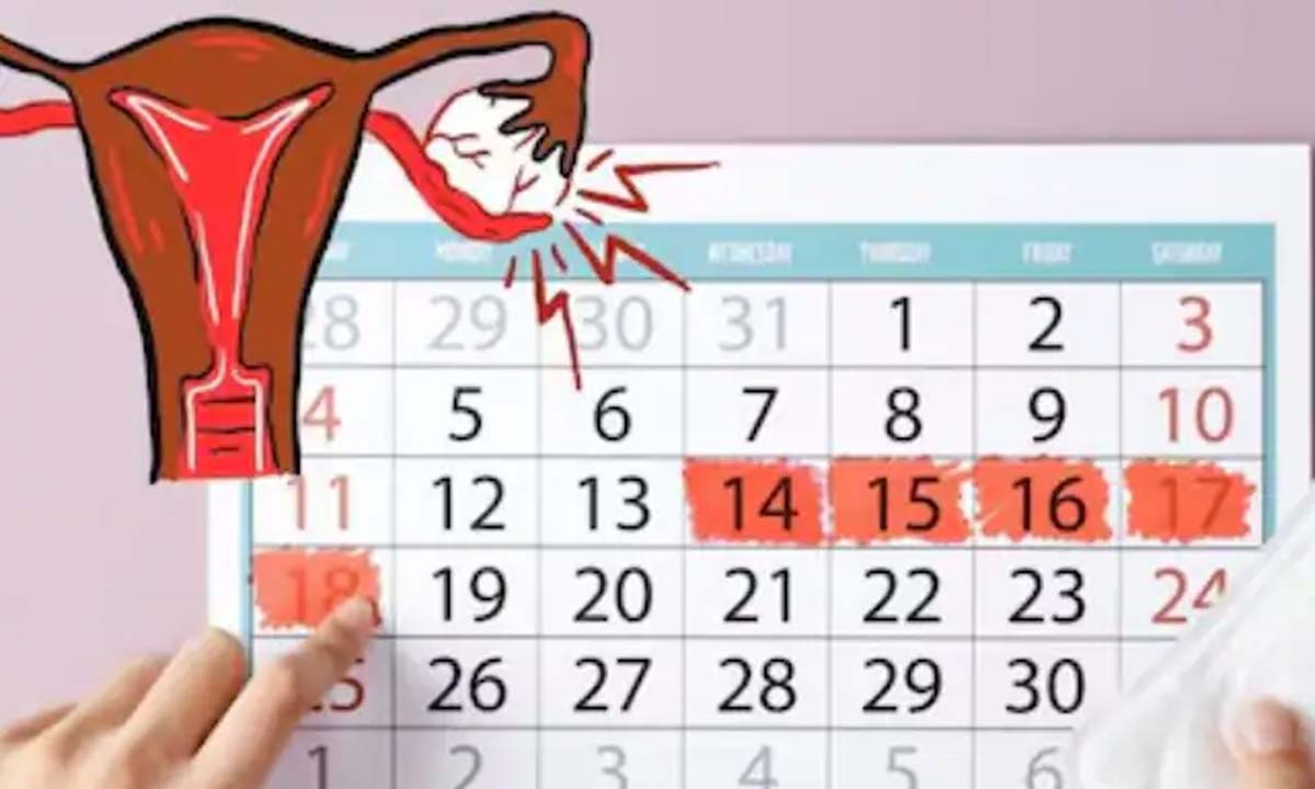 Understanding Irregular Periods Beyond PCOS