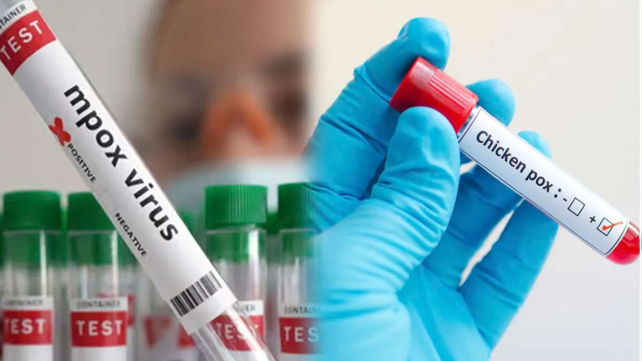 India's Indigenous RT-PCR Kit for Mpox Gains Drug Regulator Approval